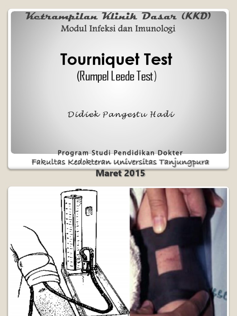 Tourniquet Test (Rumpel Leede Test) by DR - Didiek | PDF