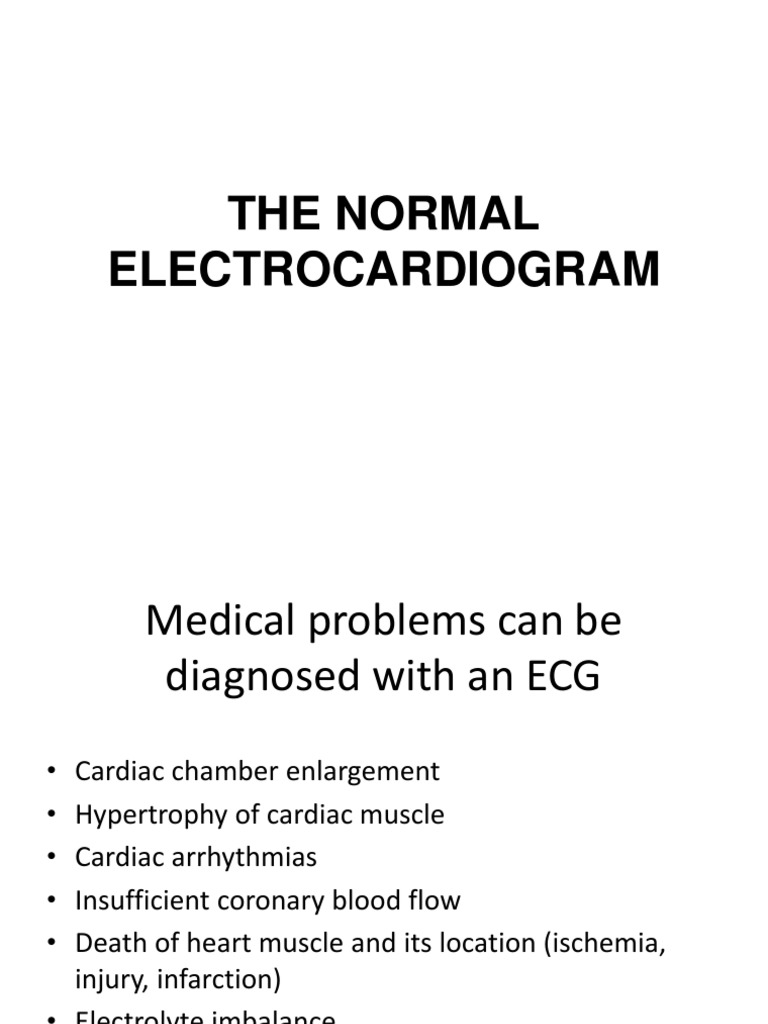 The Normal Electrocardiogram | PDF | Electrocardiography ...