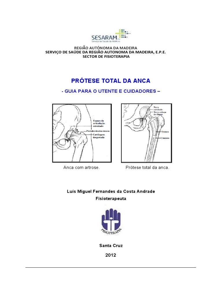 Prótese Anca Guia Utente e Cuidador | PDF | Osteoartrite | Prótese