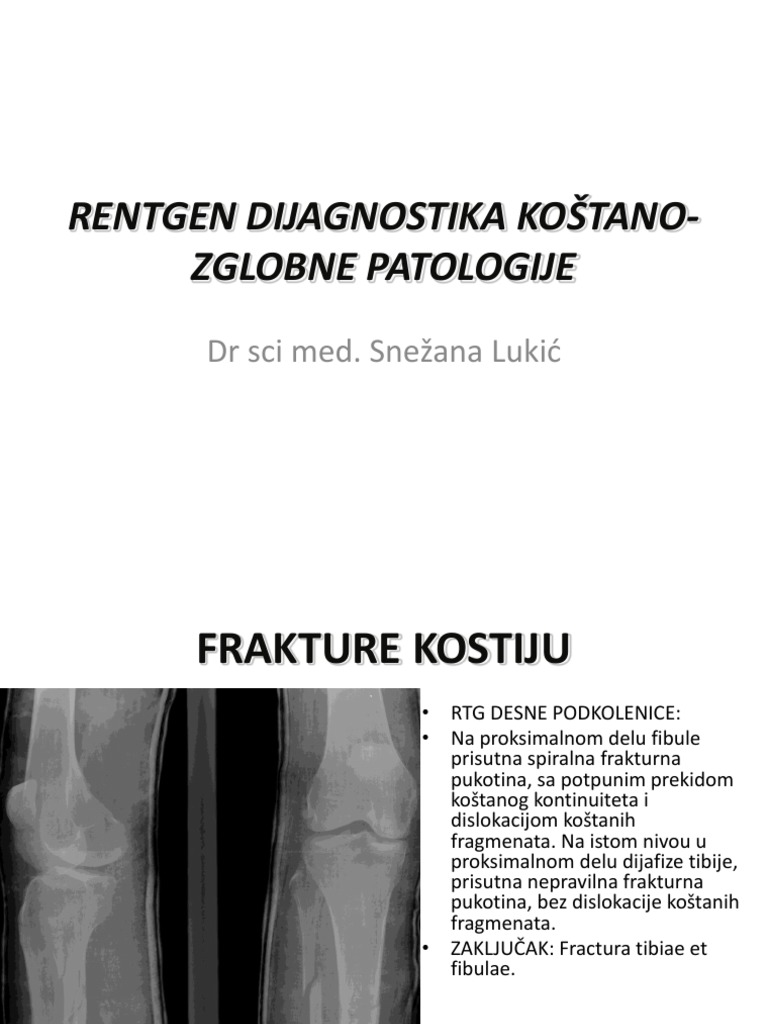 Koštano Zglobne | PDF