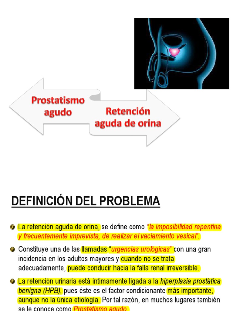 Prostatismo Agudo - Usjb | Descargar gratis PDF | Vejiga urinaria ...