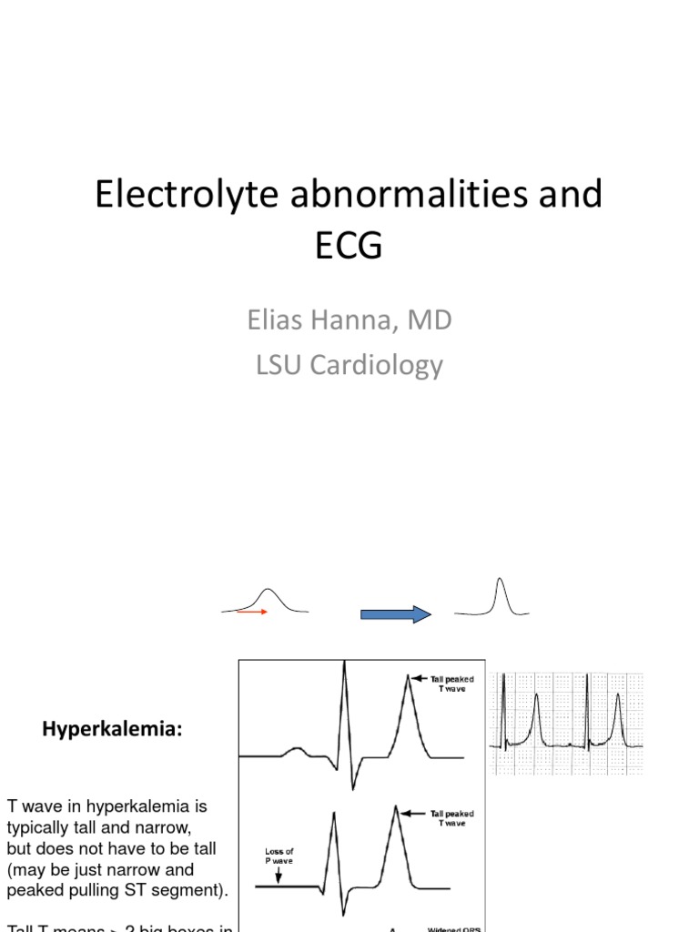 Electrolyte Abnormalities and ECG: Elias Hanna, MD LSU Cardiology | PDF