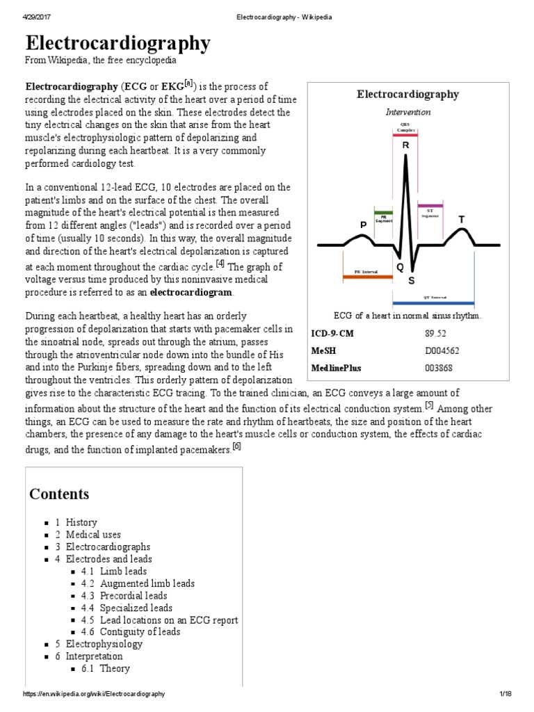 Electrocardiography - Wikipedia | Electrocardiography | Cardiac Arrhythmia