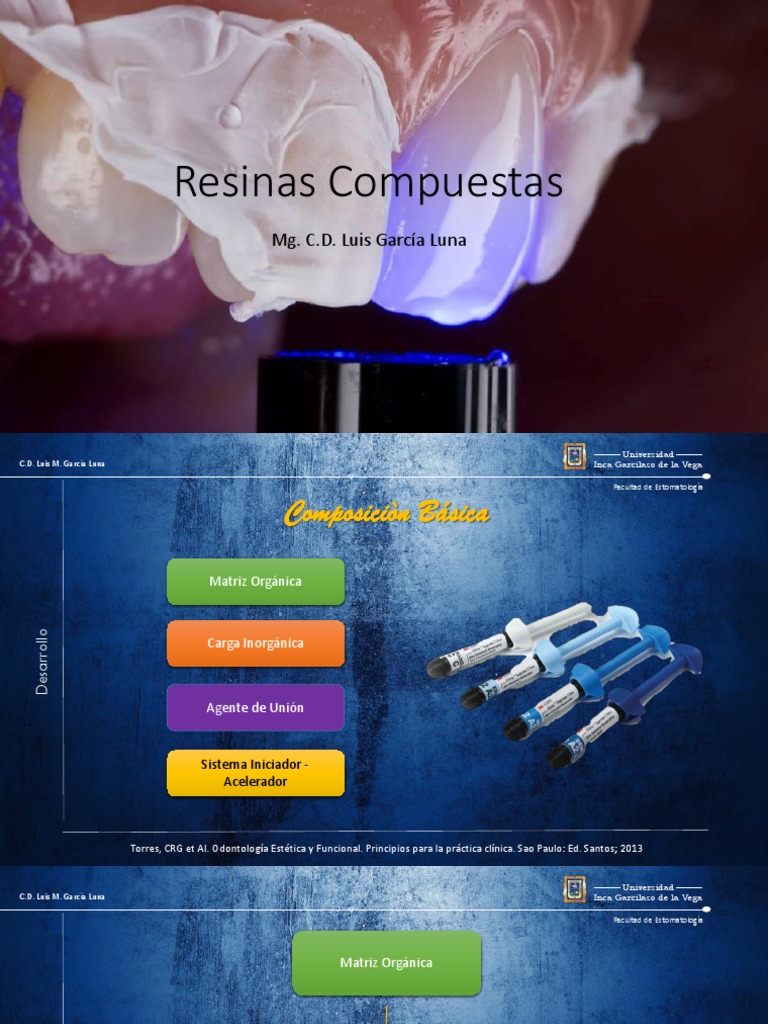 Resinas Compuestas | Esmalte de dientes | Odontología