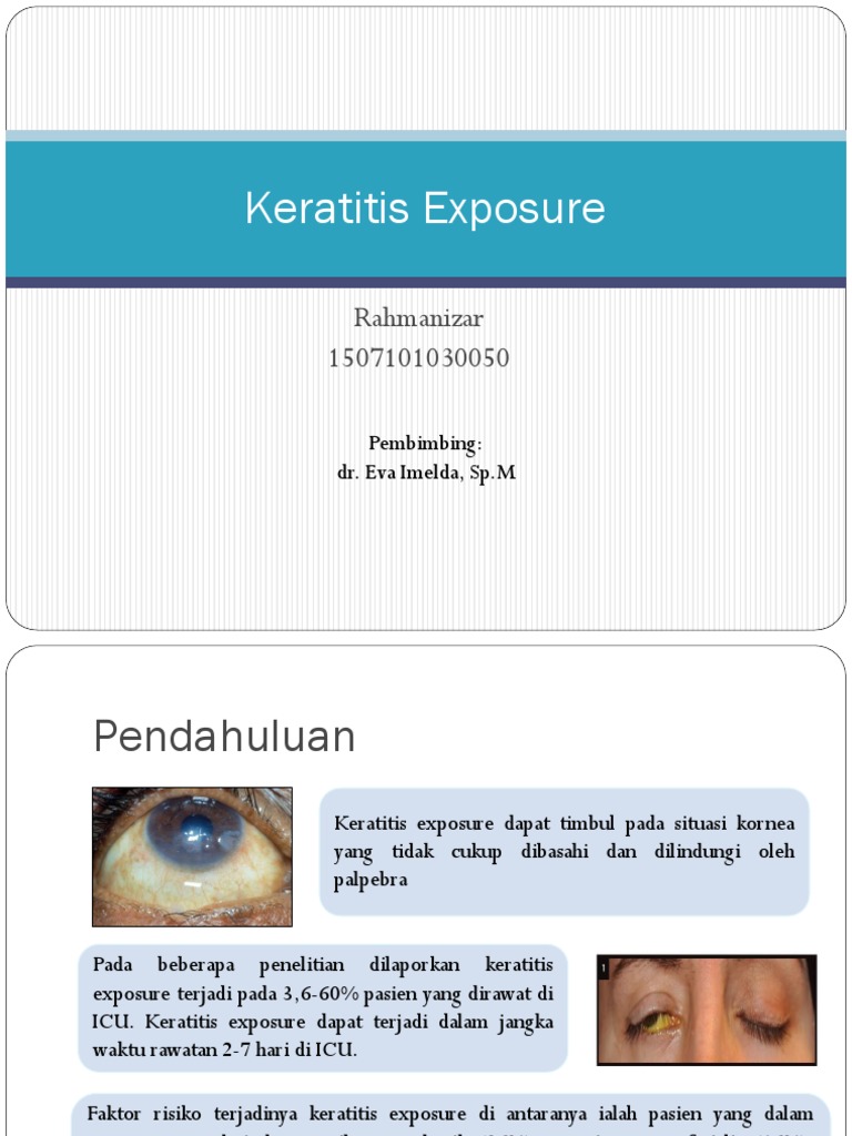 Keratitis Exposure | PDF