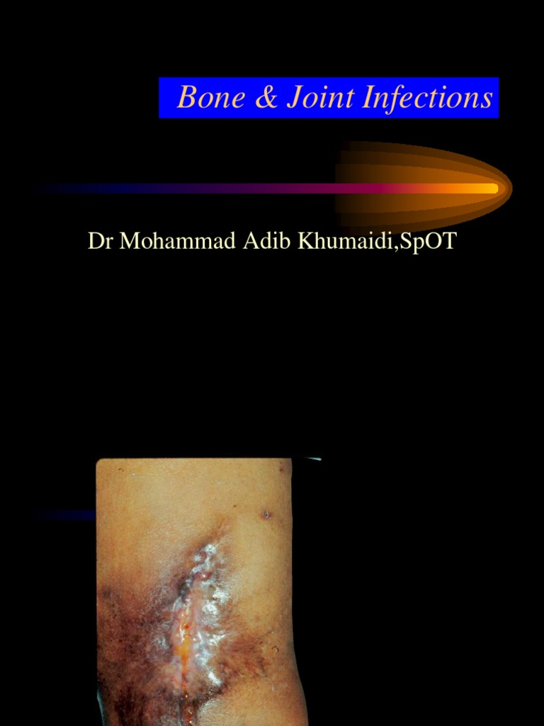 Bone and Joint Infection | PDF | Arthritis | Medical Specialties