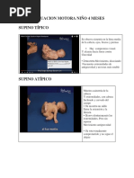 Test Adams | PDF | Escoliosis | Especialidades Medicas