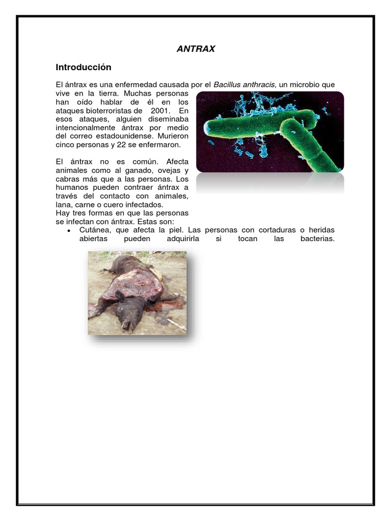 ANTRAX | Ántrax | Medicina clínica