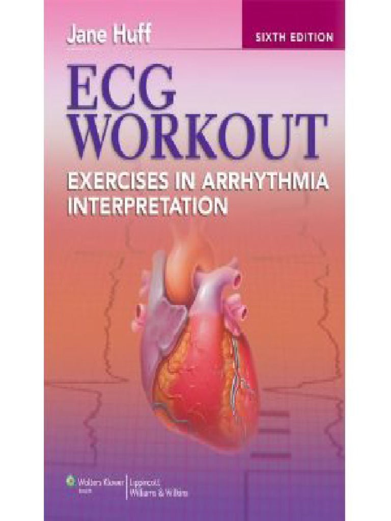 Huff - ECG Workout - Exercises in Arrhythmia Interpretation | PDF ...