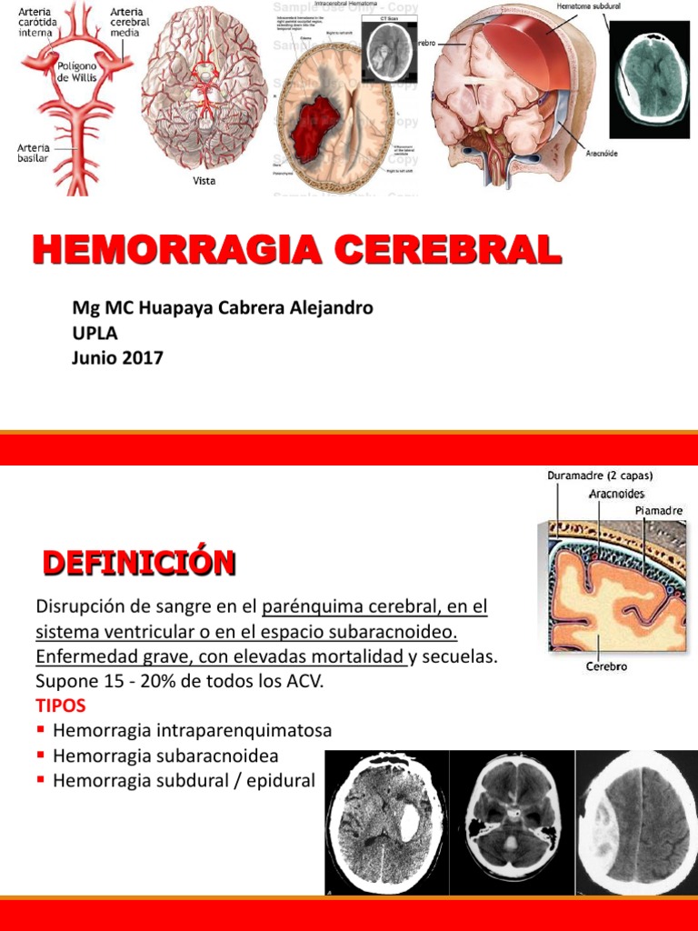 P4a 2017 6 8 Hemorragia cerebral.pptx | Especialidades médicas ...