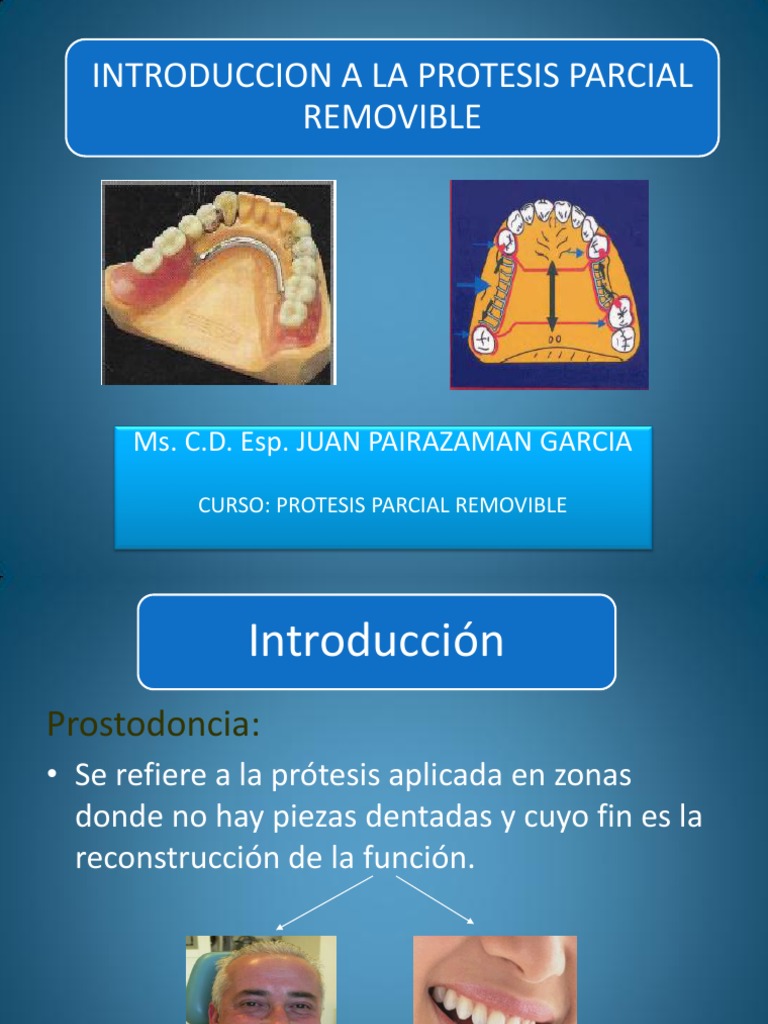 Introducción a la protesis parcial removible (ppr) | Dentadura postiza ...