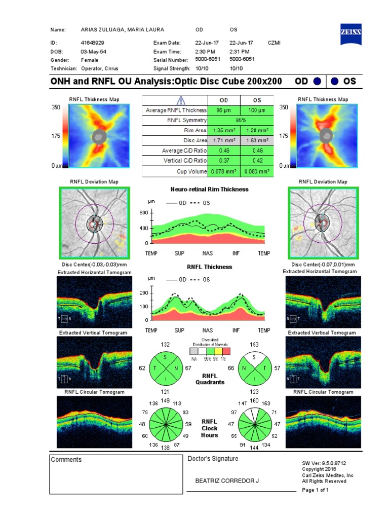 OS OD ONH and RNFL OU Analysis:Optic Disc Cube 200x200 | PDF