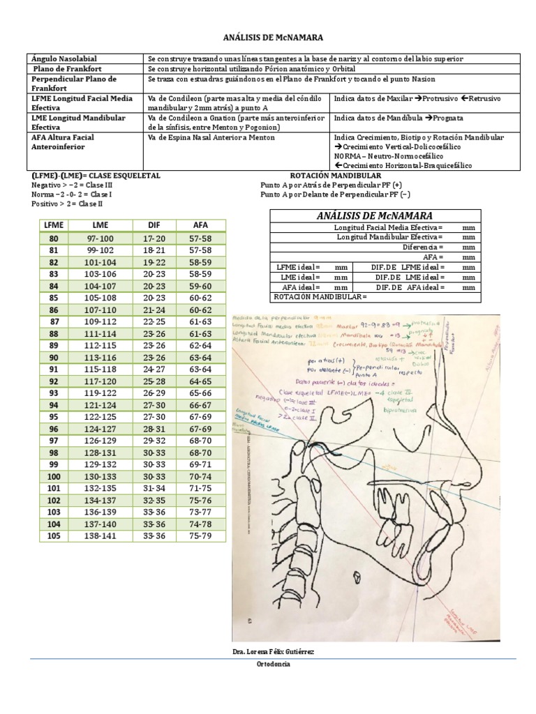 ANÁLISIS DE McNAMARA | PDF