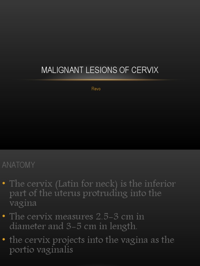 CA Cervix | PDF | Cervical Cancer | Carcinoma
