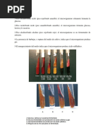 Retortamonas intestinalis: Protozoo Intestinal | PDF | Biología | Medicina
