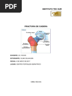 Clasificación Garden en Fracturas de Cadera | PDF | Traumatologia ...