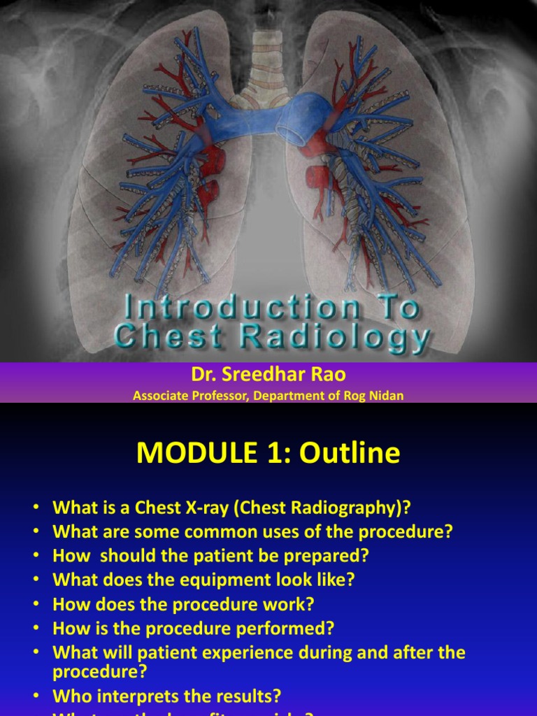 Fundamentals of Chest Radiology | Download Free PDF | Lung | X Ray