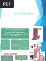 Varices Esofágicas | PDF | Especialidades Medicas | Medicina CLINICA