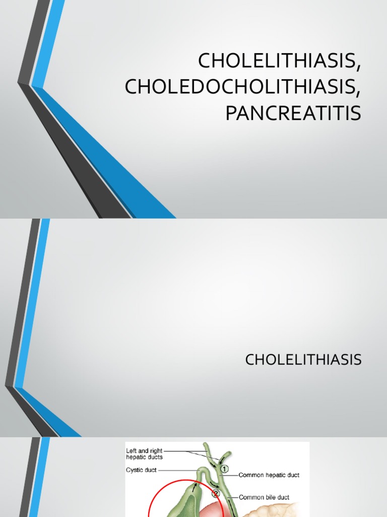 Cholelithiasis, Choledocholithiasis, Pancreatitis | Download Free PDF ...