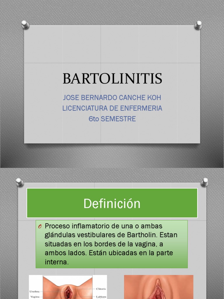 BARTOLINITIS | PDF | Salud y bienestar