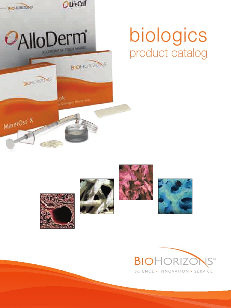 Catalogo Biohorizons | PDF | Dental Implant | Bone