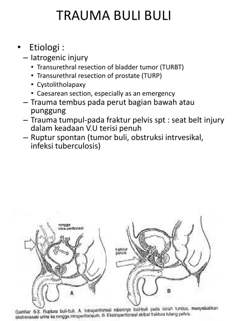 Trauma Buli Buli | PDF