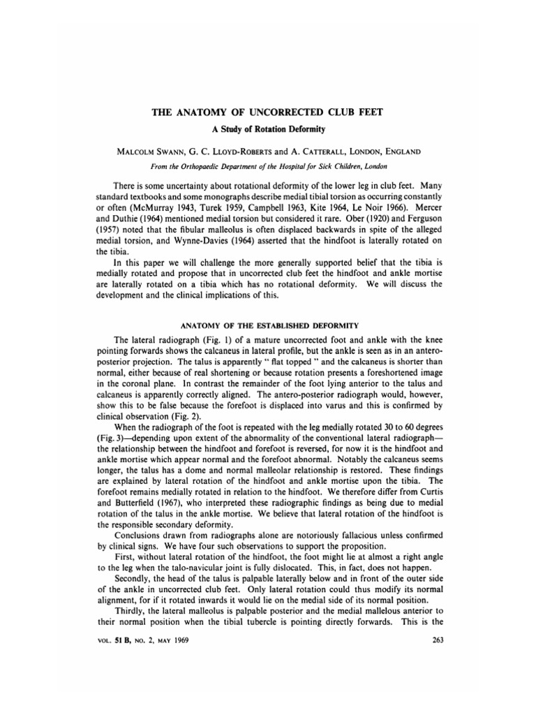 OF Uncorrected Club Feet A Study: Malcolm Swann, Lloyd-Roberts ...