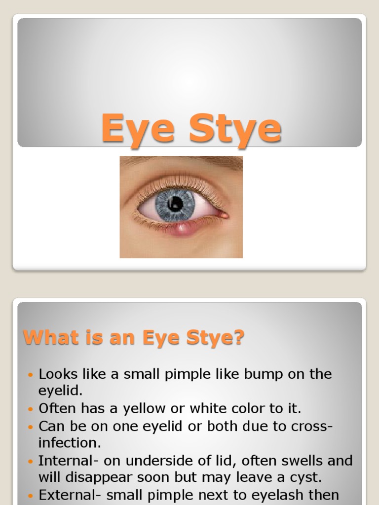 Stye | PDF