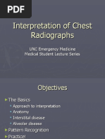 Chest X-ray Interpretation Masterclass | PDF