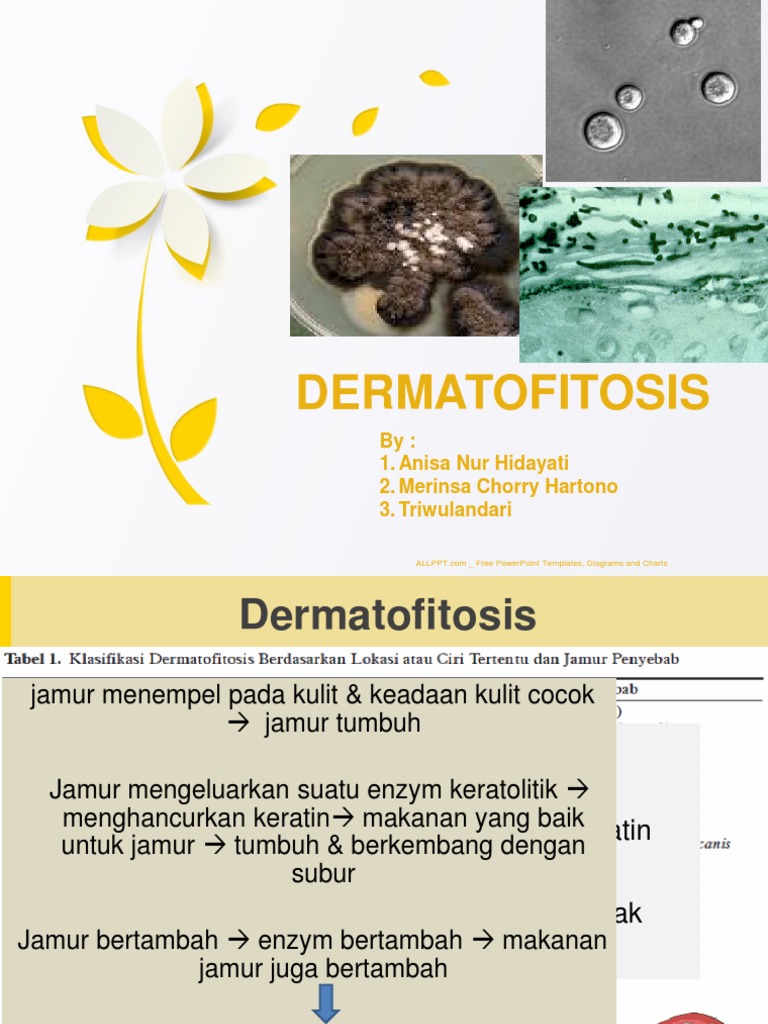 Dermatofitosis | PDF
