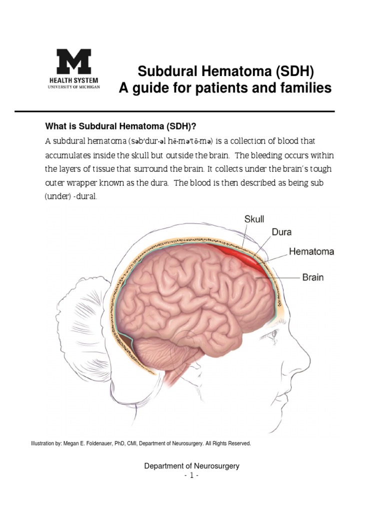 Sdh | Traumatic Brain Injury | Medical Specialties