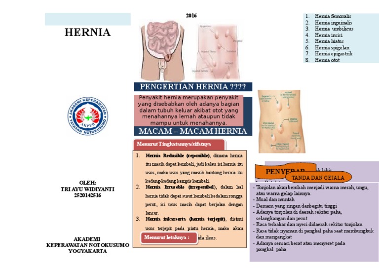 Leaflet Hernia | PDF