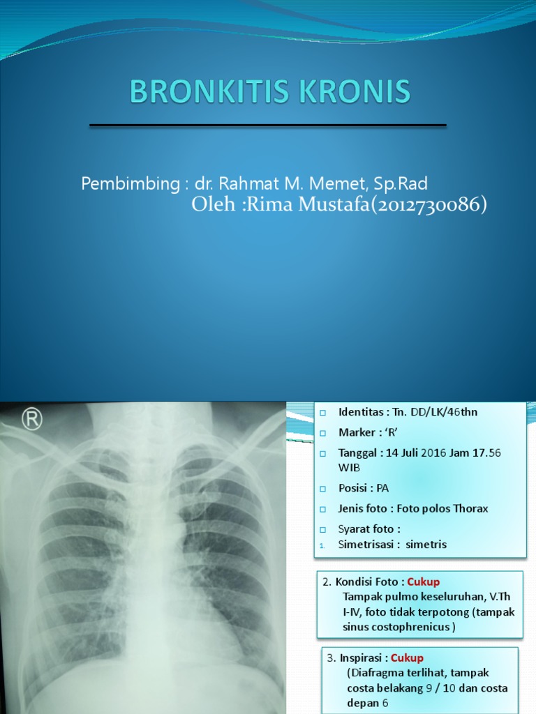 Laporan Kasus Bronkitis Kronik | PDF