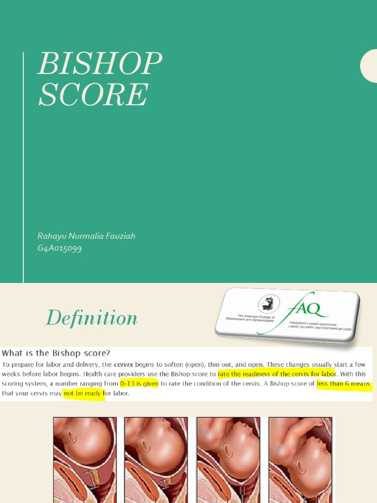 Assessing Cervical Ripeness: A Guide to the Bishop Score for Labor ...