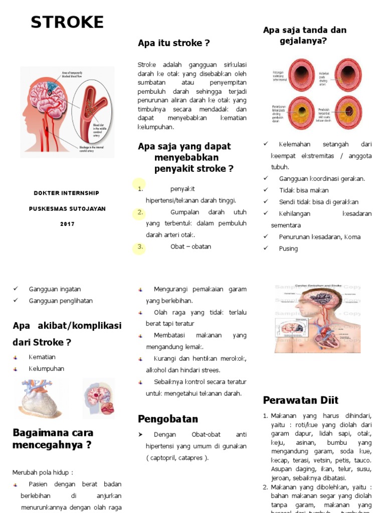 Leaflet Stroke | PDF