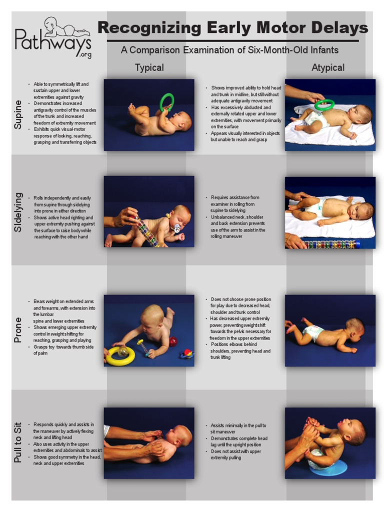 Recognizing Early Motor Delays: A Comparison Examination of Six-Month ...