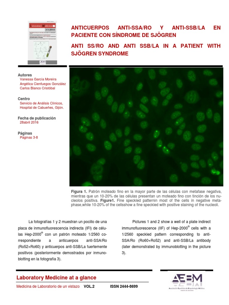 Anticuerpos Anti Ssa Ro y Anti Ssb La | Enfermedad autoinmune ...