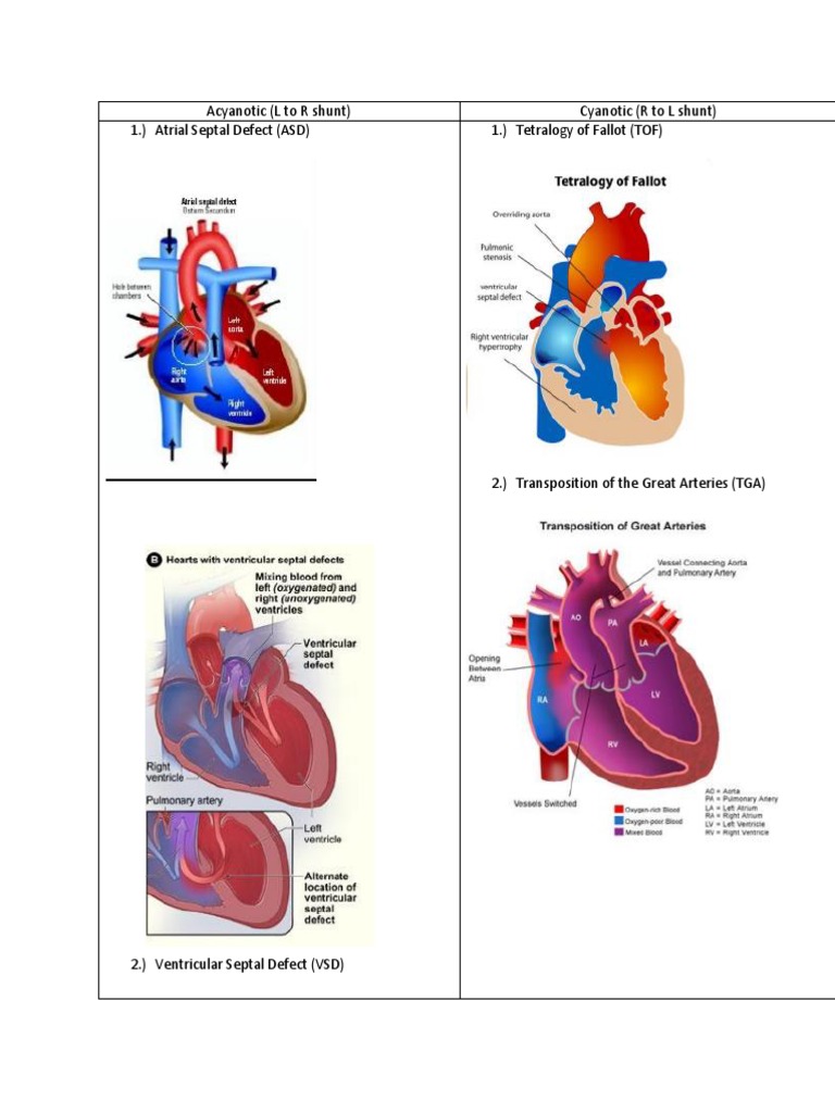 Acyanotic (L To R Shunt) Cyanotic (R To L Shunt) 1.) Atrial Septal ...