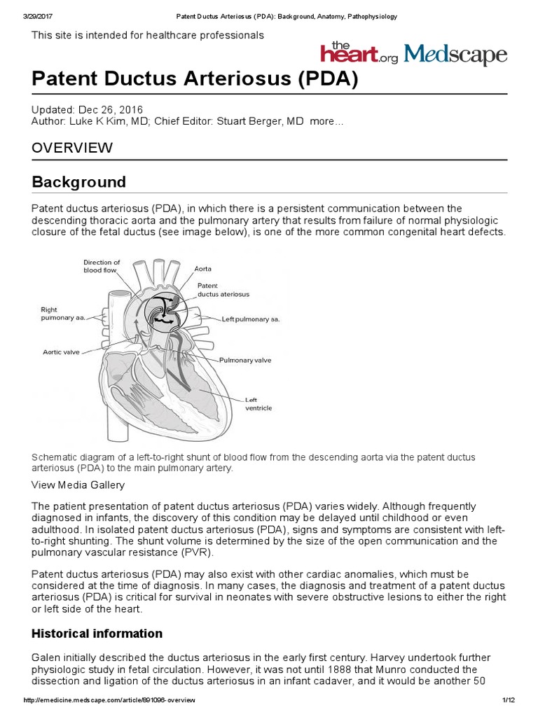 Patent Ductus Arteriosus PDA Background Anatomy Pathophysiology | Aorta ...