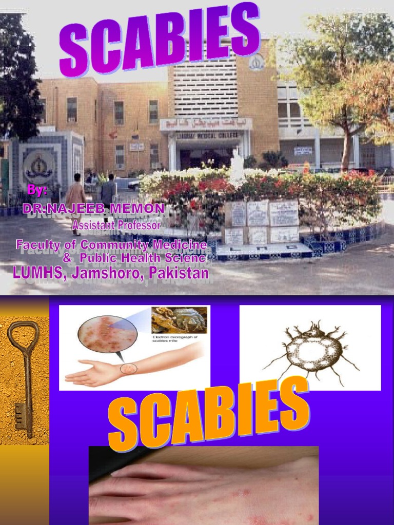 Scabies by DR Najeeb Memon Pakistan | PDF | Medical Specialties ...
