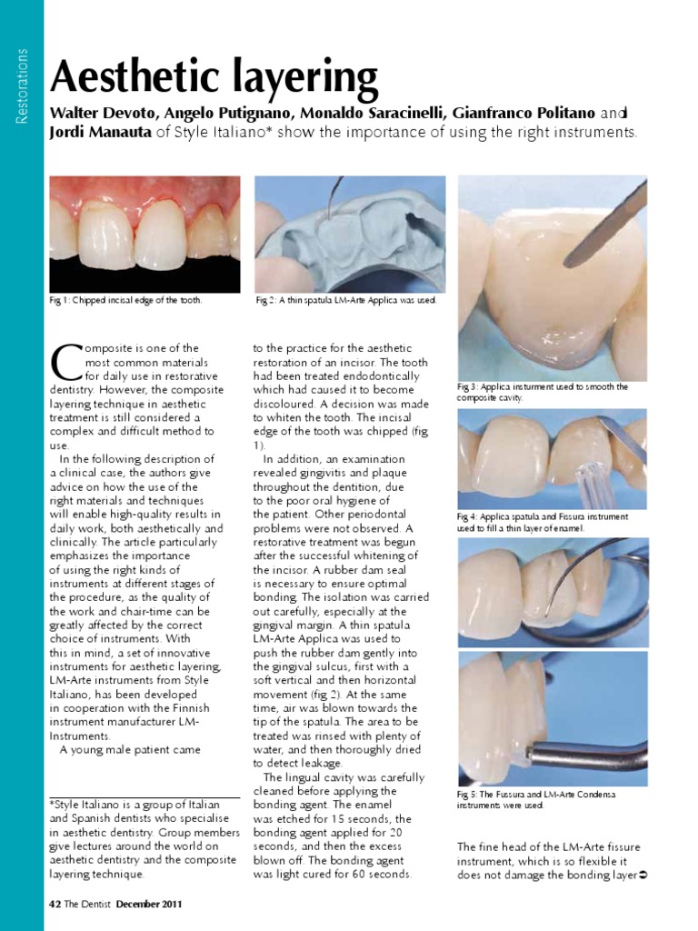 pg42-44 Aesthetic Layering PDF | PDF | Dental Composite | Mouth