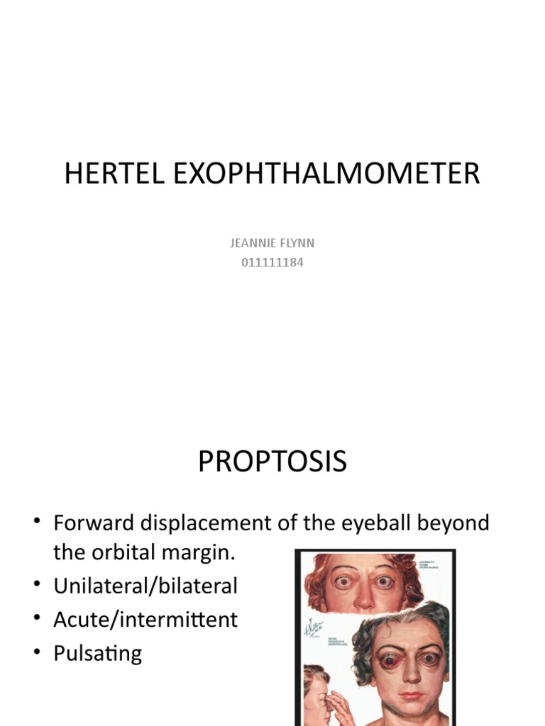 Pemeriksaan Hertel | PDF