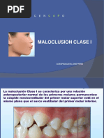 Clasificación de Angle y Maloclusiones | PDF | Boca | Diente