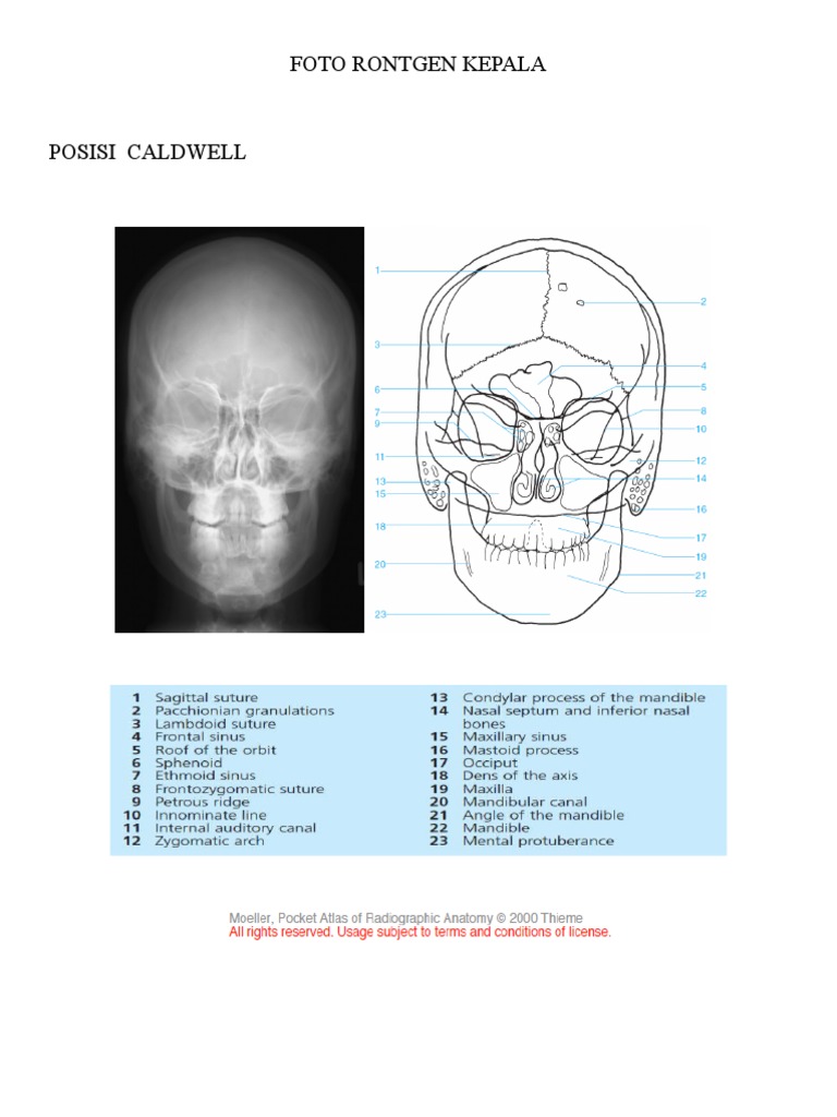 Rontgen Kepala | PDF