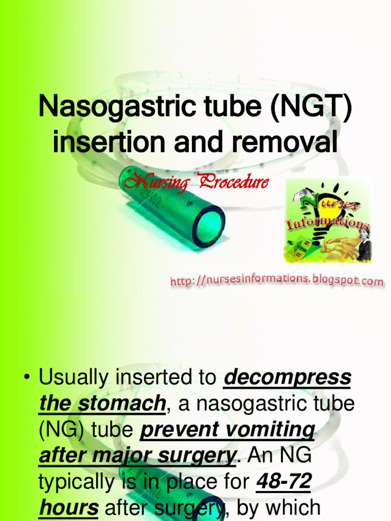 Nasogastric Tube NGT 1215082454278959 8 | PDF | Gastroenterology | Medicine