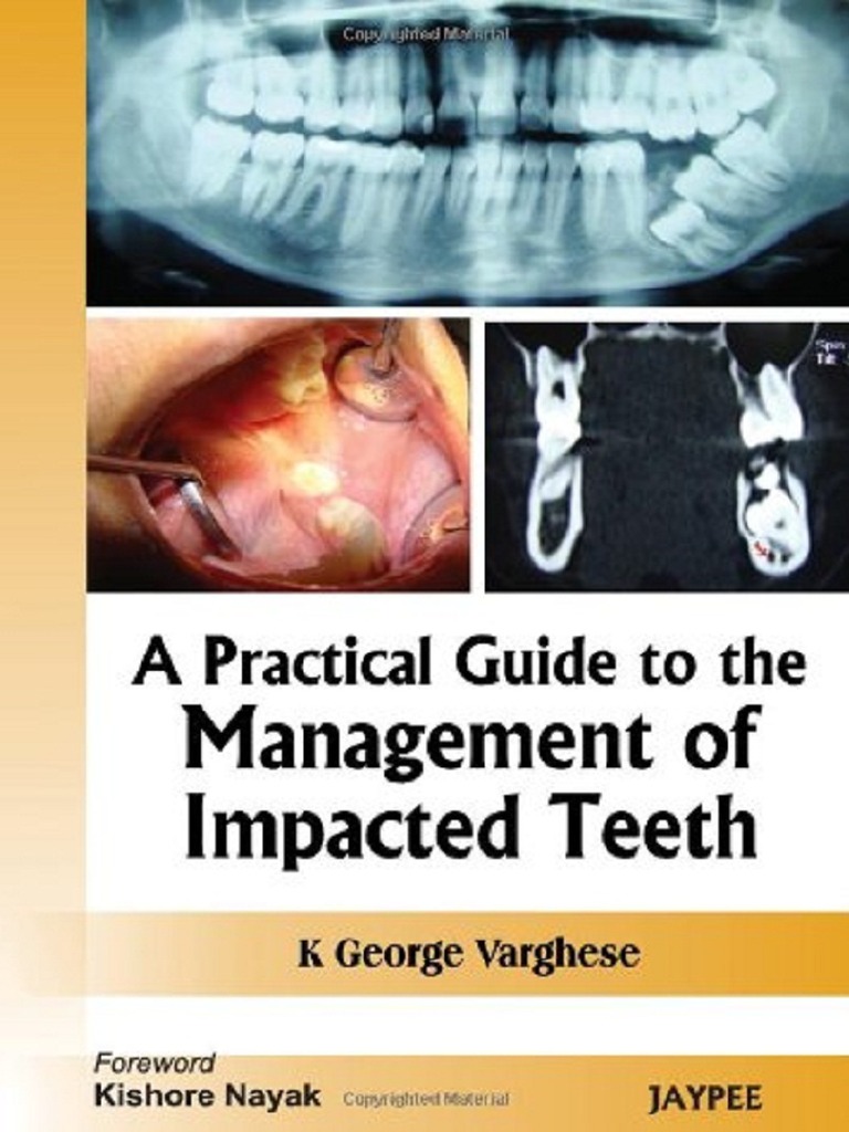 A Practical Guide To The Management of Impacted Teeth PDF | PDF | Tooth | Oral And Maxillofacial ...