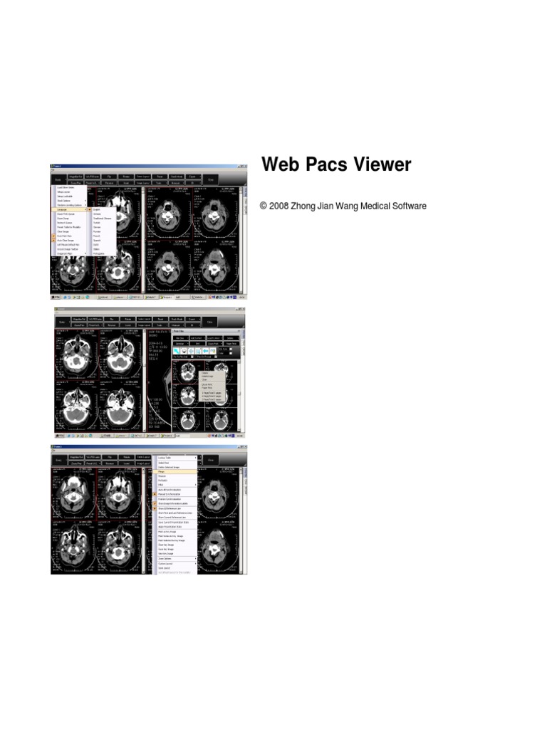 Web Pacs Viewer 2008 | PDF | Page Layout | World Wide Web