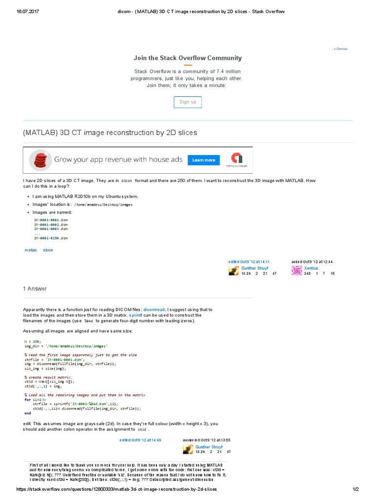 Dicom - (MATLAB) 3D CT Image Reconstruction by 2D | PDF | Voxel ...