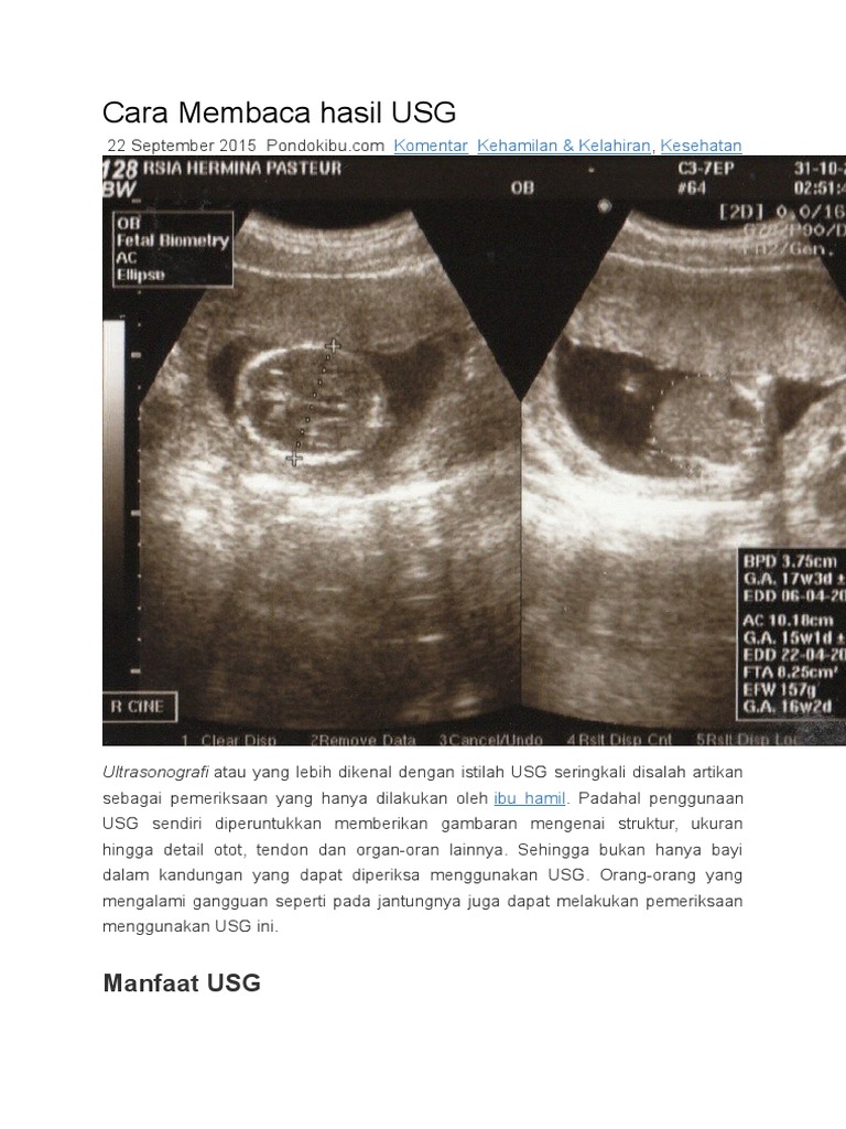 Cara Membaca Hasil USG | PDF | Kesehatan Holistik