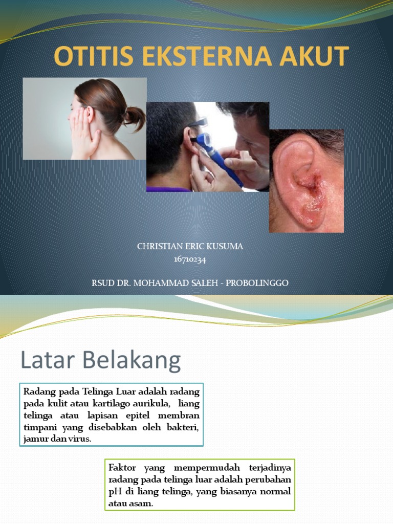 Otitis Eksterna Akut Fix | PDF